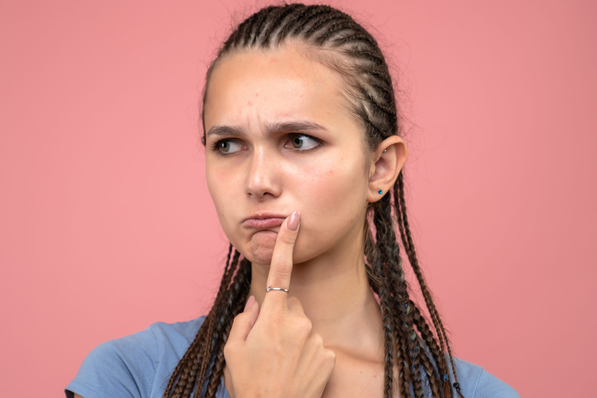 Queilite Angular (Boqueira) - O que é? Como tratar? - Dermatologia